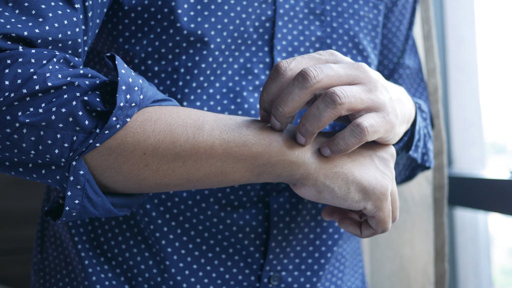 A Guide to Skin Rashes That Itch and Their Treatment Options - Insider ...